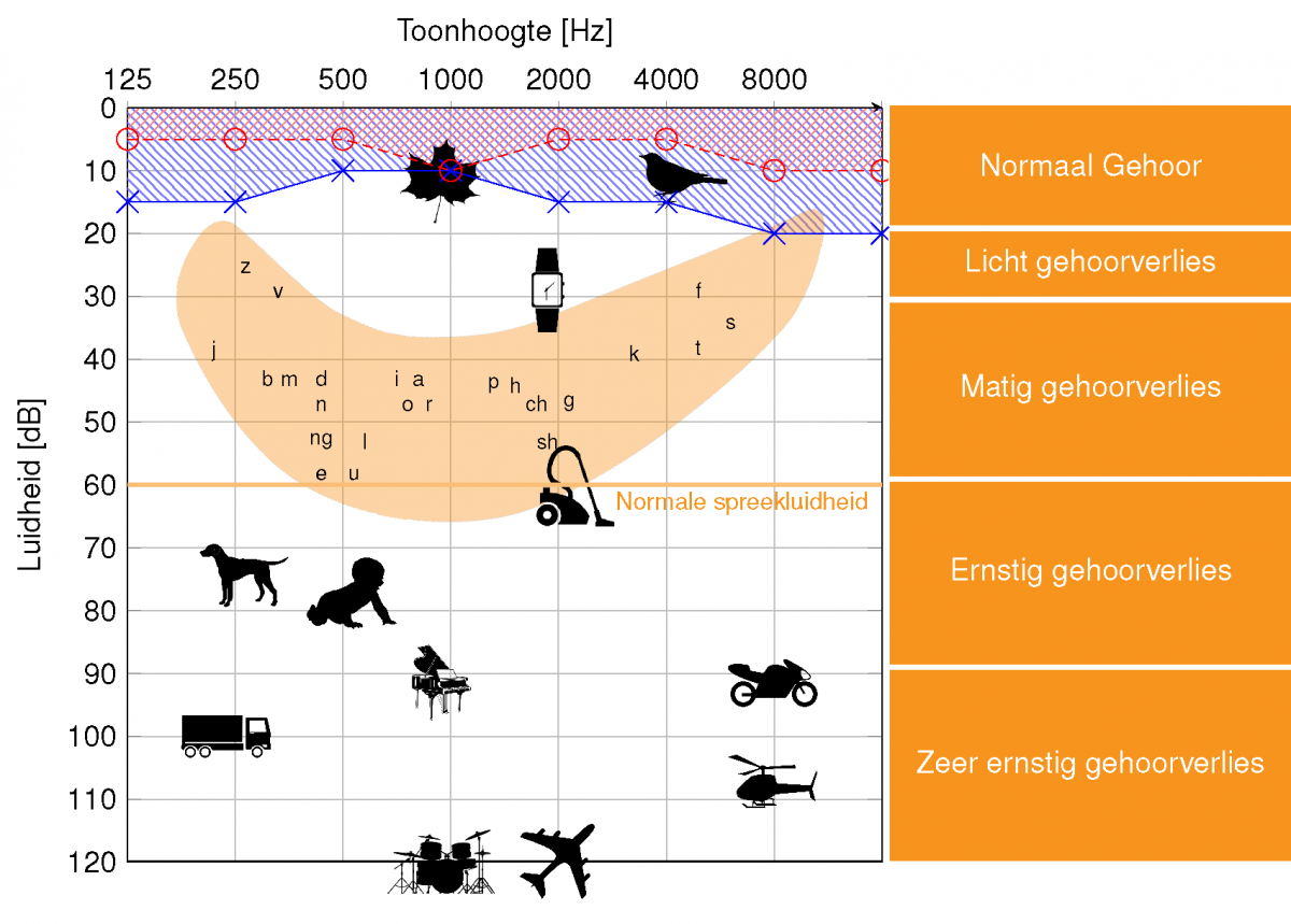Audiogram lezen - Haal meer inzicht uit jouw audiogram